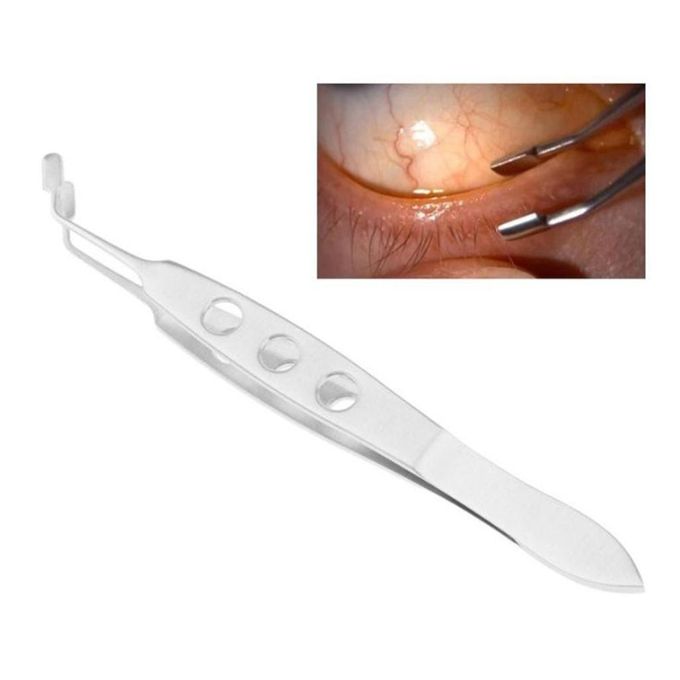Shop Generic Meibomian Gland Expressor Forceps Dry Eye Eyelid ...