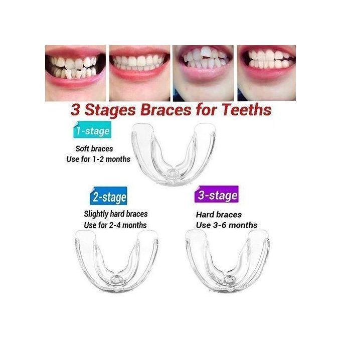 Shop Generic 3-Stage Teeth Aligner Brace – Invisible Orthodontic ...